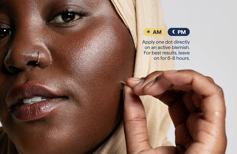REMEDY for pimples (patches) - 36ct – Remedy Science by Dr. Muneeb Shah