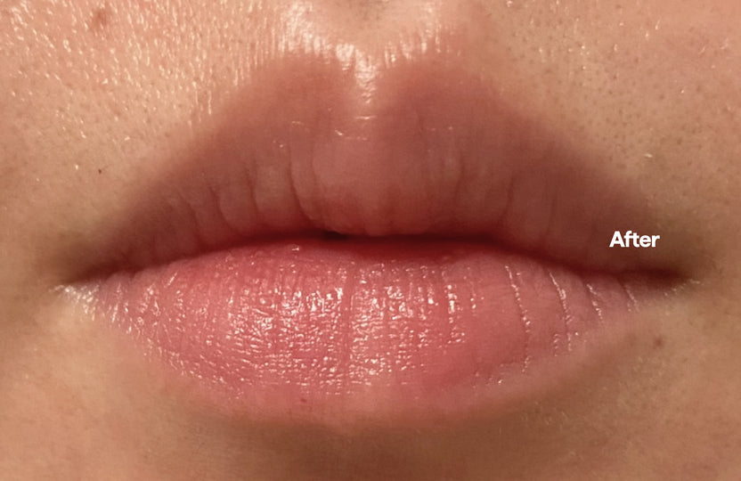 REMEDY for dry lips – Remedy Science by Dr. Muneeb Shah