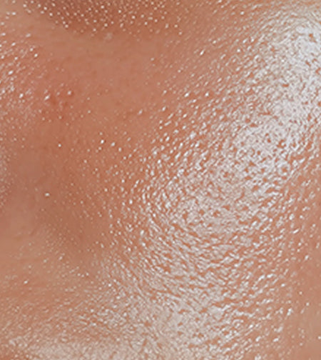 REMEDY | Advanced Dermatologist-Created Skincare – Remedy Science by Dr ...