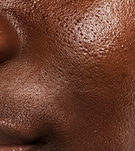 REMEDY | Advanced Dermatologist-Created Skincare – Remedy Science by Dr ...